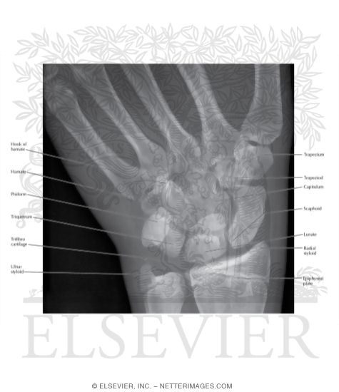 Scaphoid: AP View