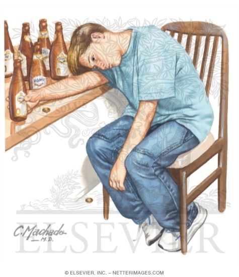 Substance Dependence (Addiction) Substance Dependence (Addiction)