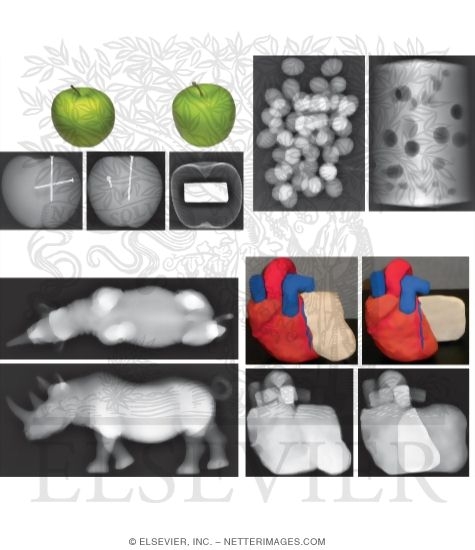 Interpretation of X-ray Densities