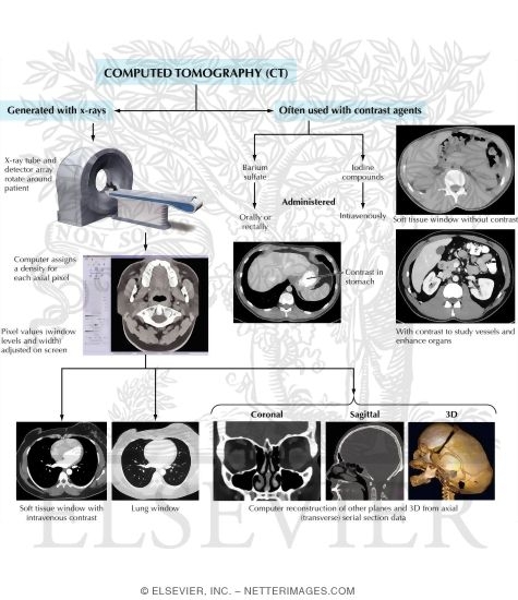 Computed Tomography (CT) Overview