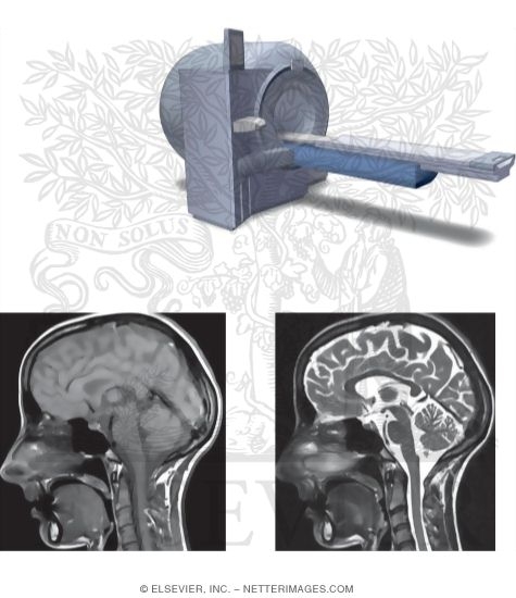 Magnetic Resonance Imaging (MRI) Overview
