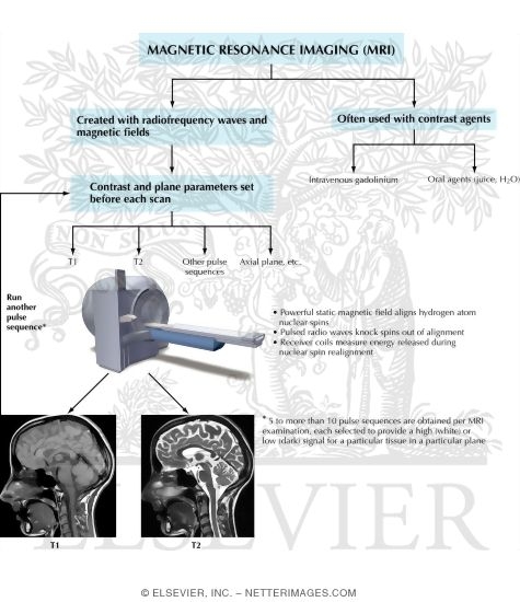 Magnetic Resonance Imaging (MRI) Overview