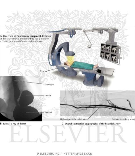 Fluoroscopy