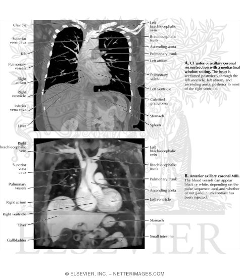 Anterior Axillary CT and MRI