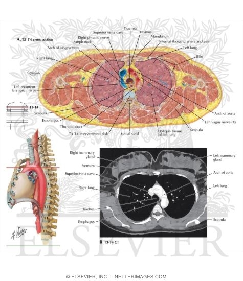 Welcome To Netter Images
