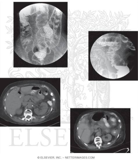 Large Intestine Imaging Studies