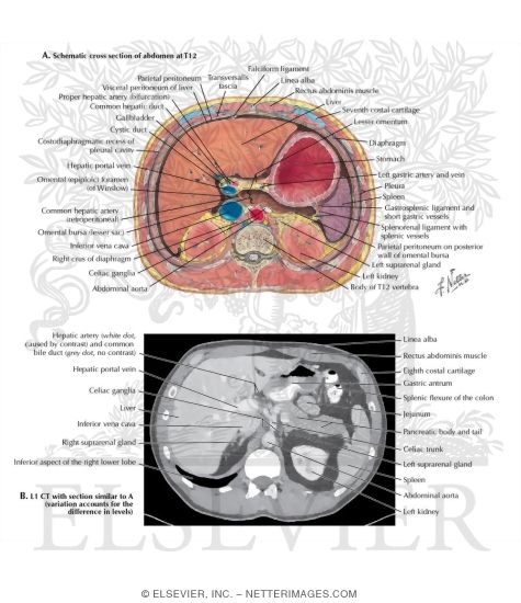 Cross Section at T12 With CT