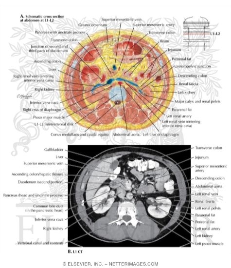 Cross Section at L1-L2 With CT