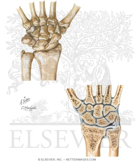 Carpal Bones and Wrist Joint