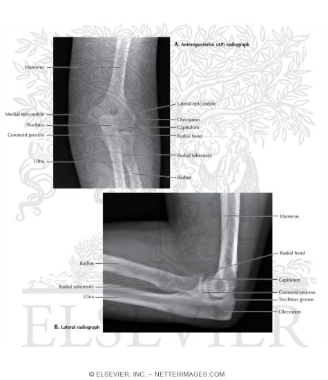 Elbow Radiographs