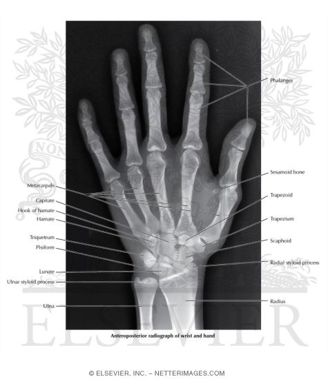 Anteroposterior Radiograph of the Wrist and Hand