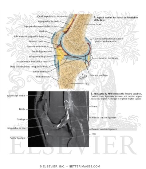 Sagittal Section of the Knee Joint and T2 MRI