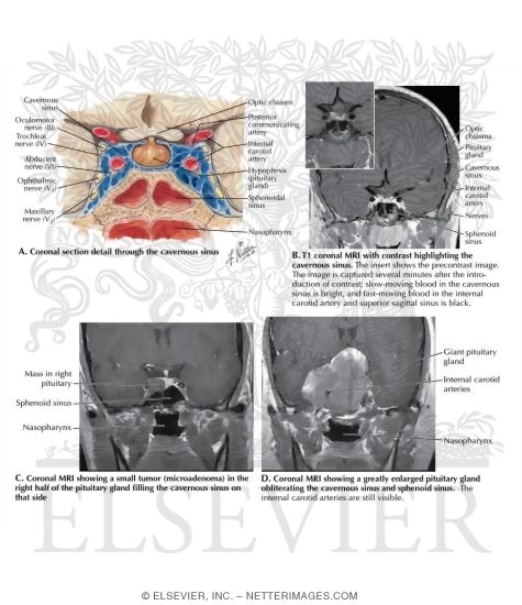 Cavernous Sinus Netter