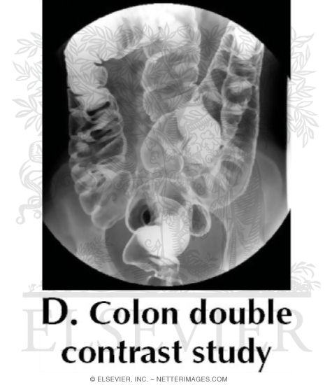 Colon Double Contrast Study