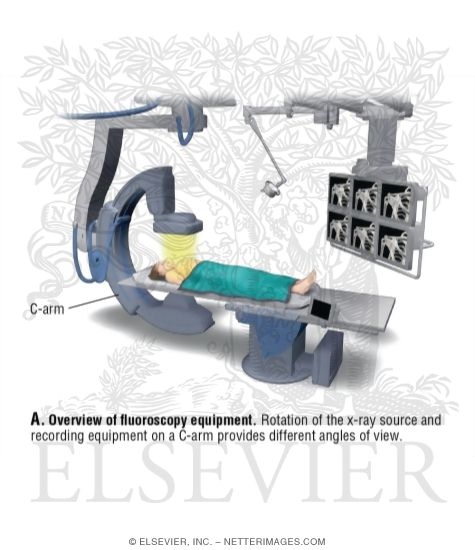 Overview of Fluoroscopy Equipment