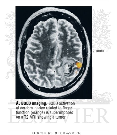 BOLD Imaging