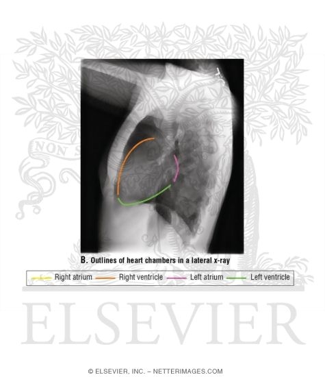 Lateral Chest X-Ray: Male