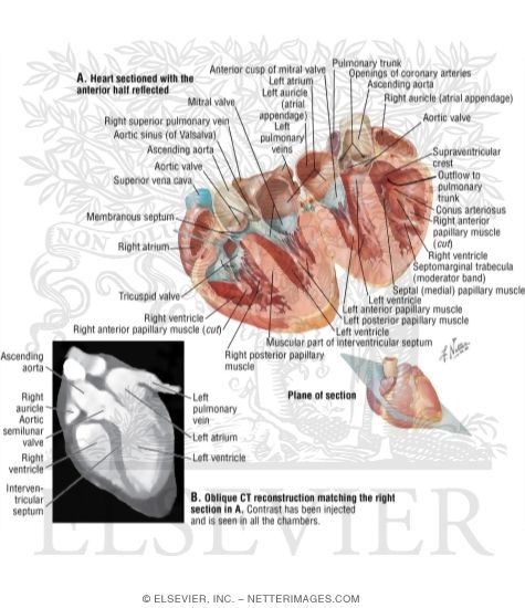 Interventricular Septum