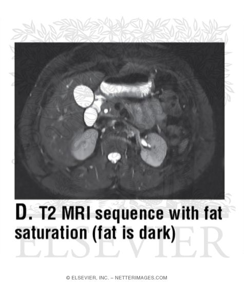 Watermarked preview of unlabeled image: CT Vs. MRI In Abdominal Studies