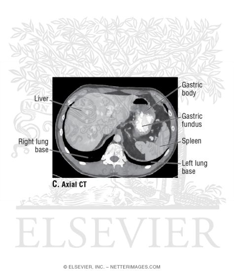 Upper Gastrointestinal CT Studies