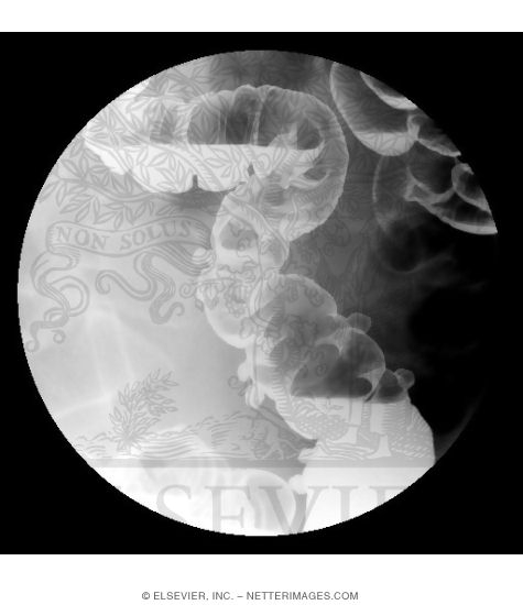 Large Intestine Imaging Studies