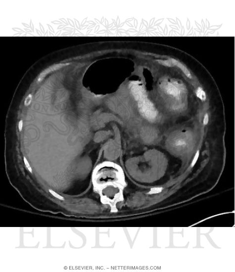 Large Intestine Imaging Studies