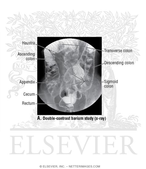 Large Intestine Imaging Studies