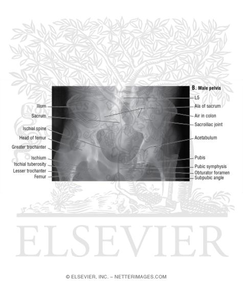 Male Pelvis: Radiograph