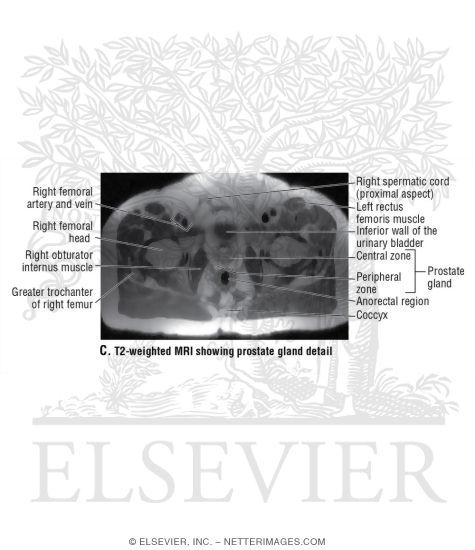 T2-Weighted MRI Showing Prostate Gland Detail