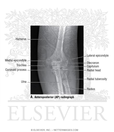 Anteroposterior (AP) Radiograph of the Elbow