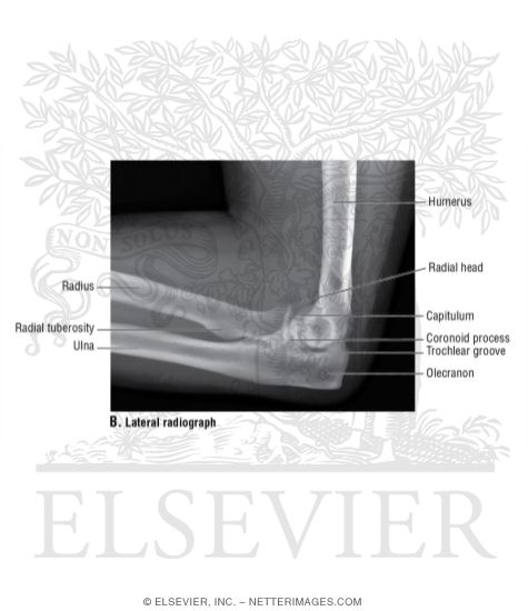 Lateral Radiograph of the Elbow