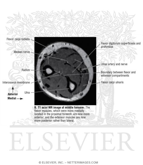 T1 Axial MR Image of Middle Forearm