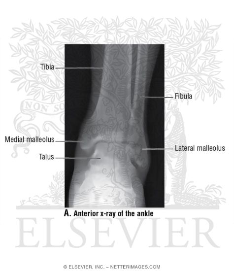 Anterior X-Ray of the Ankle