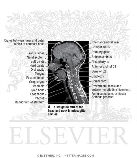 midsagittal head labeled