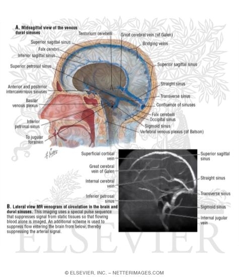 dural venous sinuses