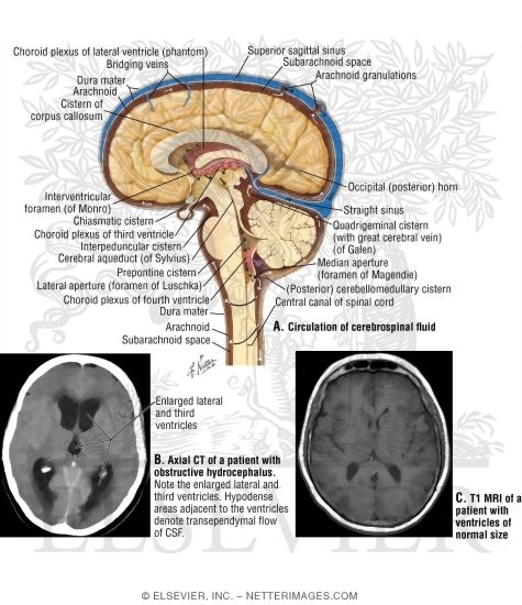 Circulation of Cerebrospinal Fluid and Hydrocephalus