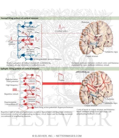 Origin and Spread of Seizures