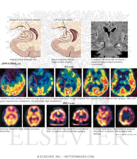 Neuroimaging Studies