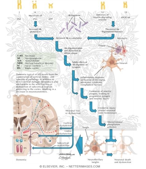 Amyloid Cascade Hypothesis In Alzheimer's Disease