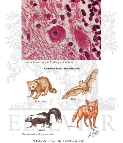 Rabies