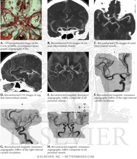Intracranial Arterial Imaging With CT and MRI
