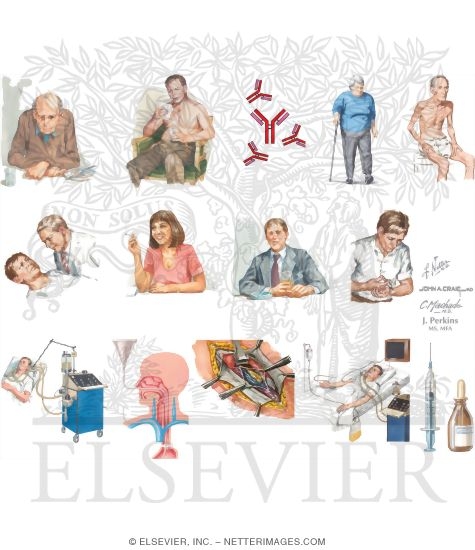 Risk Factors for the Development of Hospital-Acquired Pneumonia
