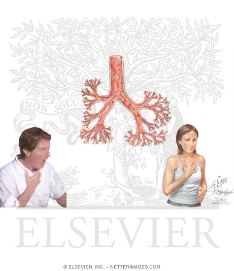 Cardinal Manifestations of Exacerbation of Chronic Obstructive ...