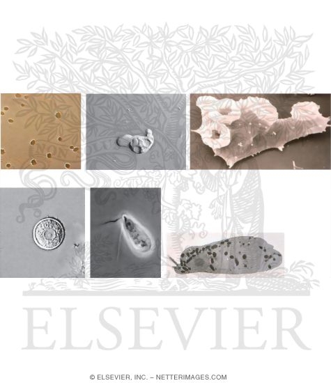 Morphology of the Three Life Stages of Naegleria Fowleri