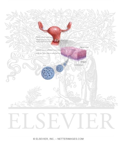 Sexually Transmitted Infections: Human Papillomavirus (HPV)