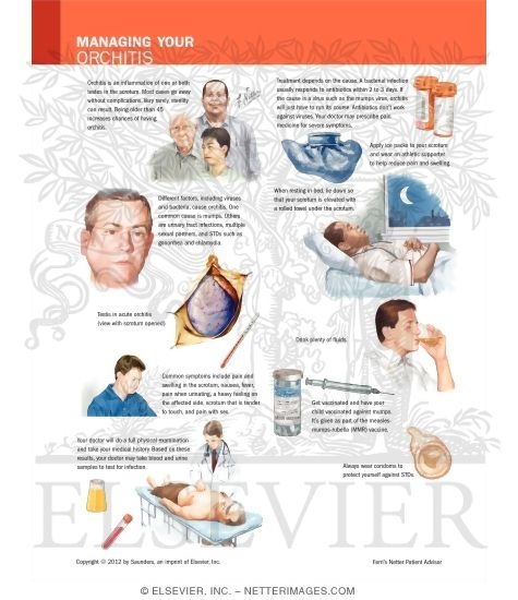 Managing Your Orchitis