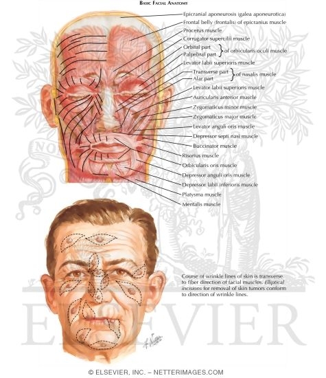 Lines of Incision for Removal of Skin Tumors of the Face