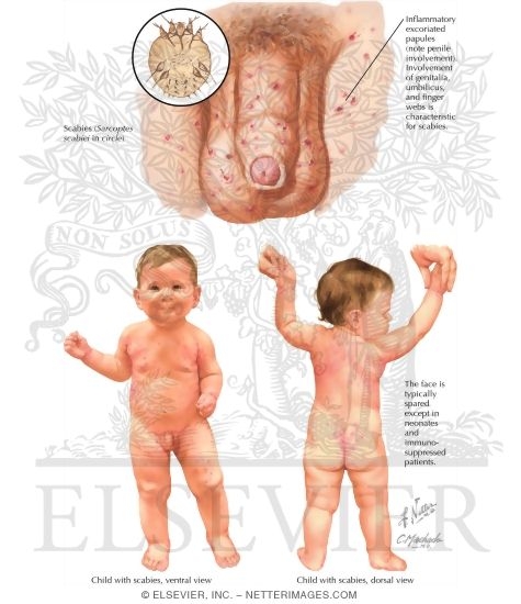 integumentary system child
