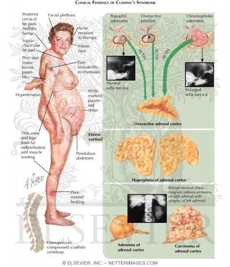 plethora face causes
