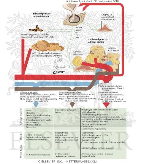 Cushing's Syndrome: Pathophysiology (Continued)